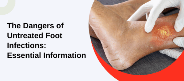 The Dangers of Untreated Foot Infections: Essential Information